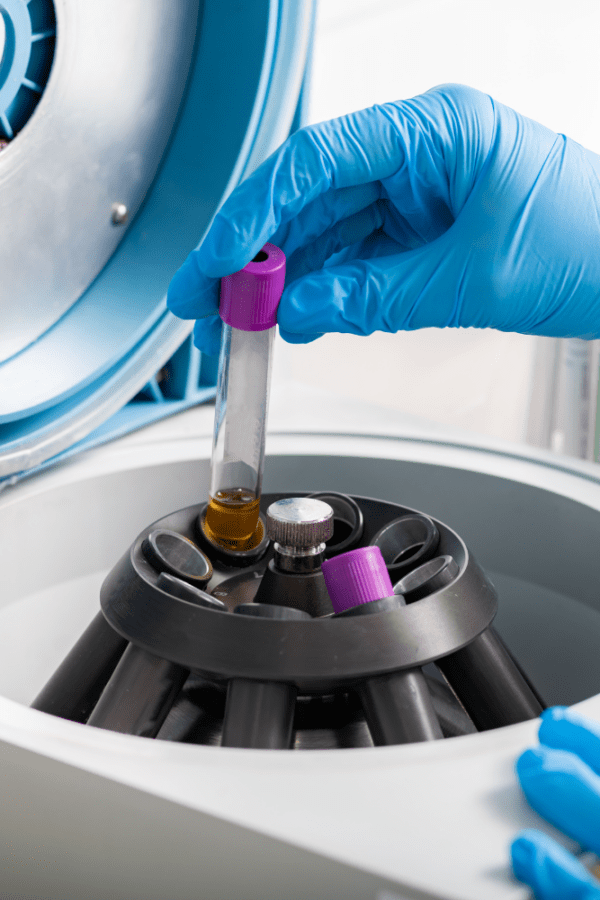 EZ Gel in Olney, MD | A Comprehensive Guide to Filler With PRF